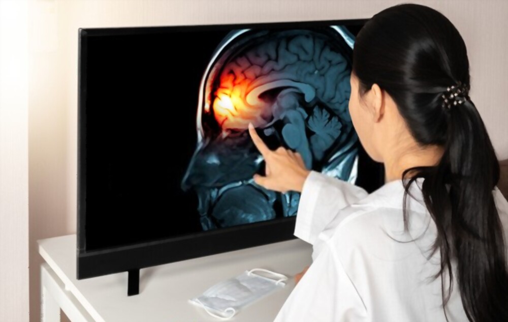 Recovery from Brain Injury and Different Postural Responses