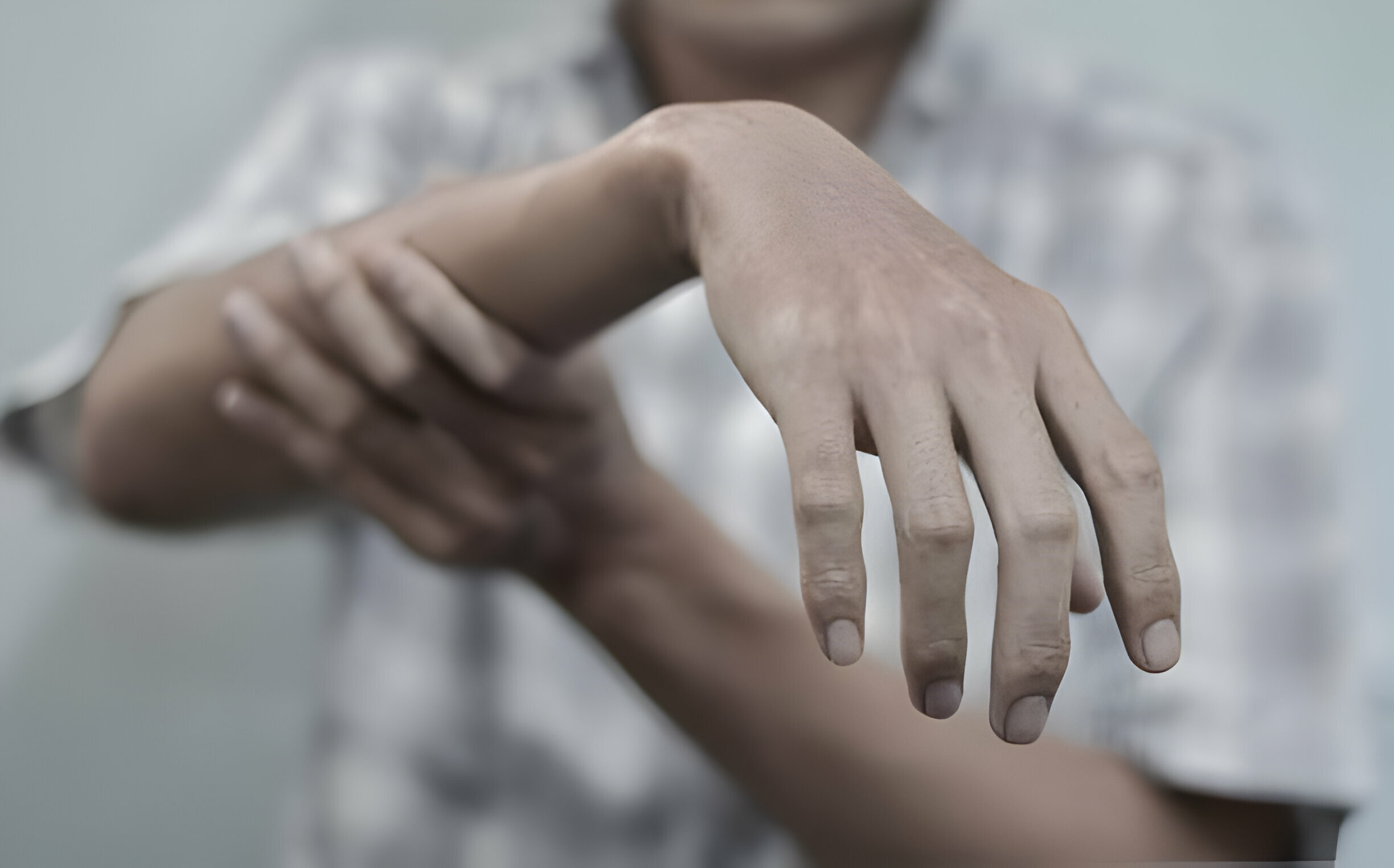 Prevention and Reversal of Contractures After Stroke