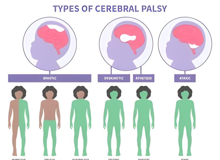 Enjoyable Activities for Children with Cerebral Palsy